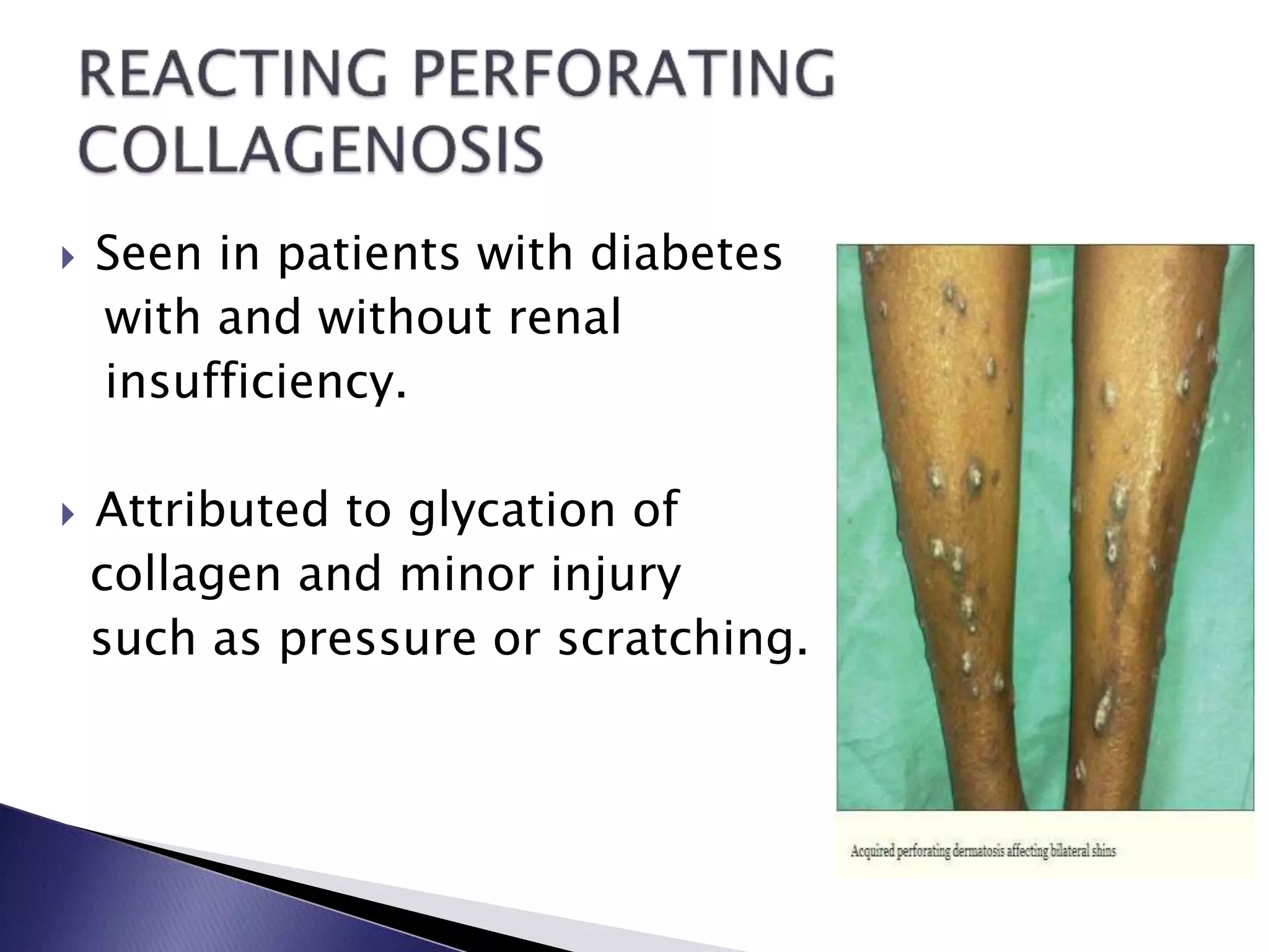 Skin or Dermatological Manifestations of Endocrine Diseases | PPTX