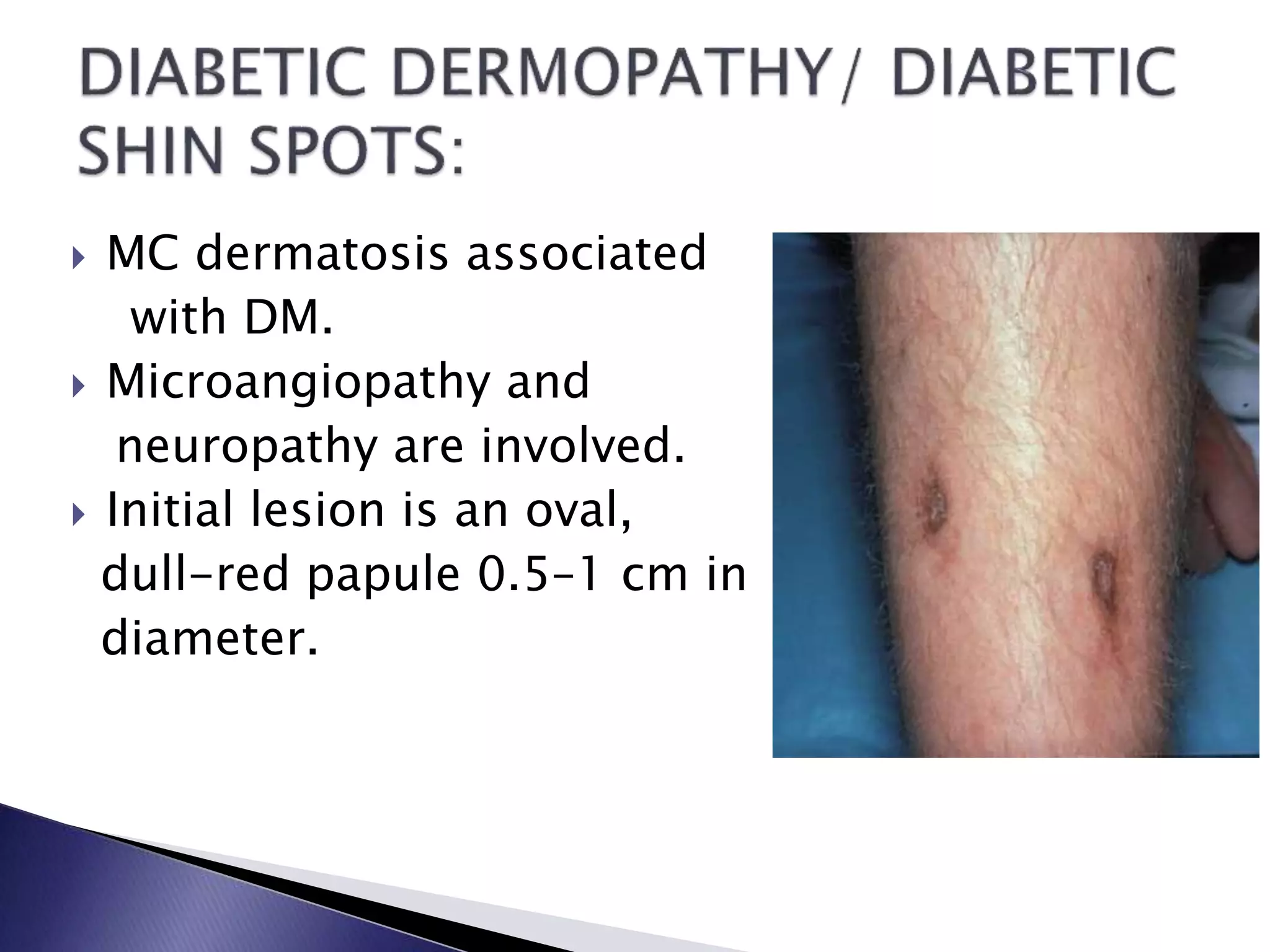 Skin or Dermatological Manifestations of Endocrine Diseases | PPTX