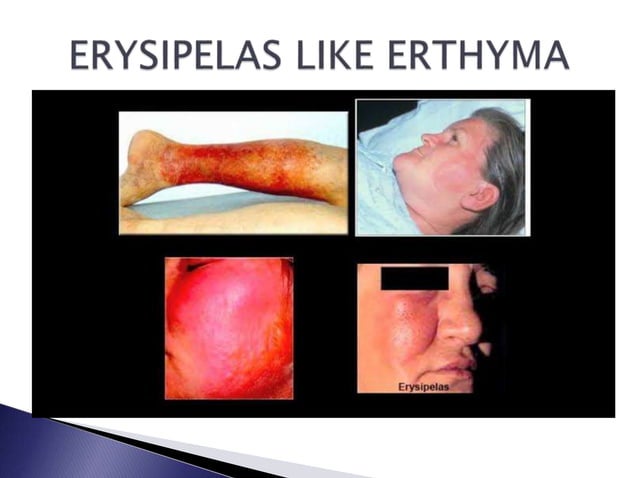 Skin or Dermatological Manifestations of Endocrine Diseases | PPTX ...