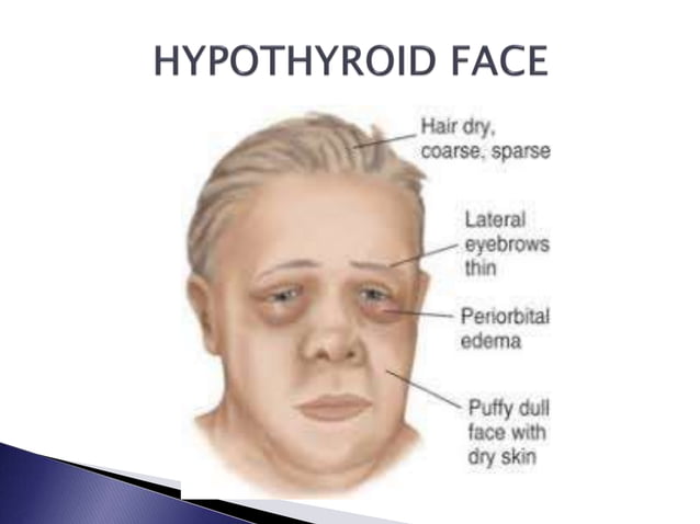 Skin or Dermatological Manifestations of Endocrine Diseases | PPTX ...