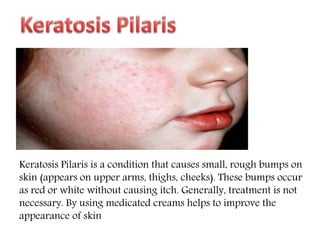 Skin disorders and their treatment | PPTX