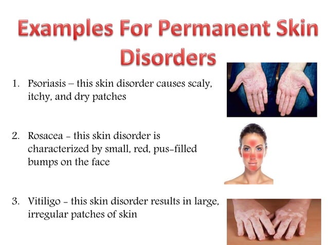 Skin disorders and their treatment
