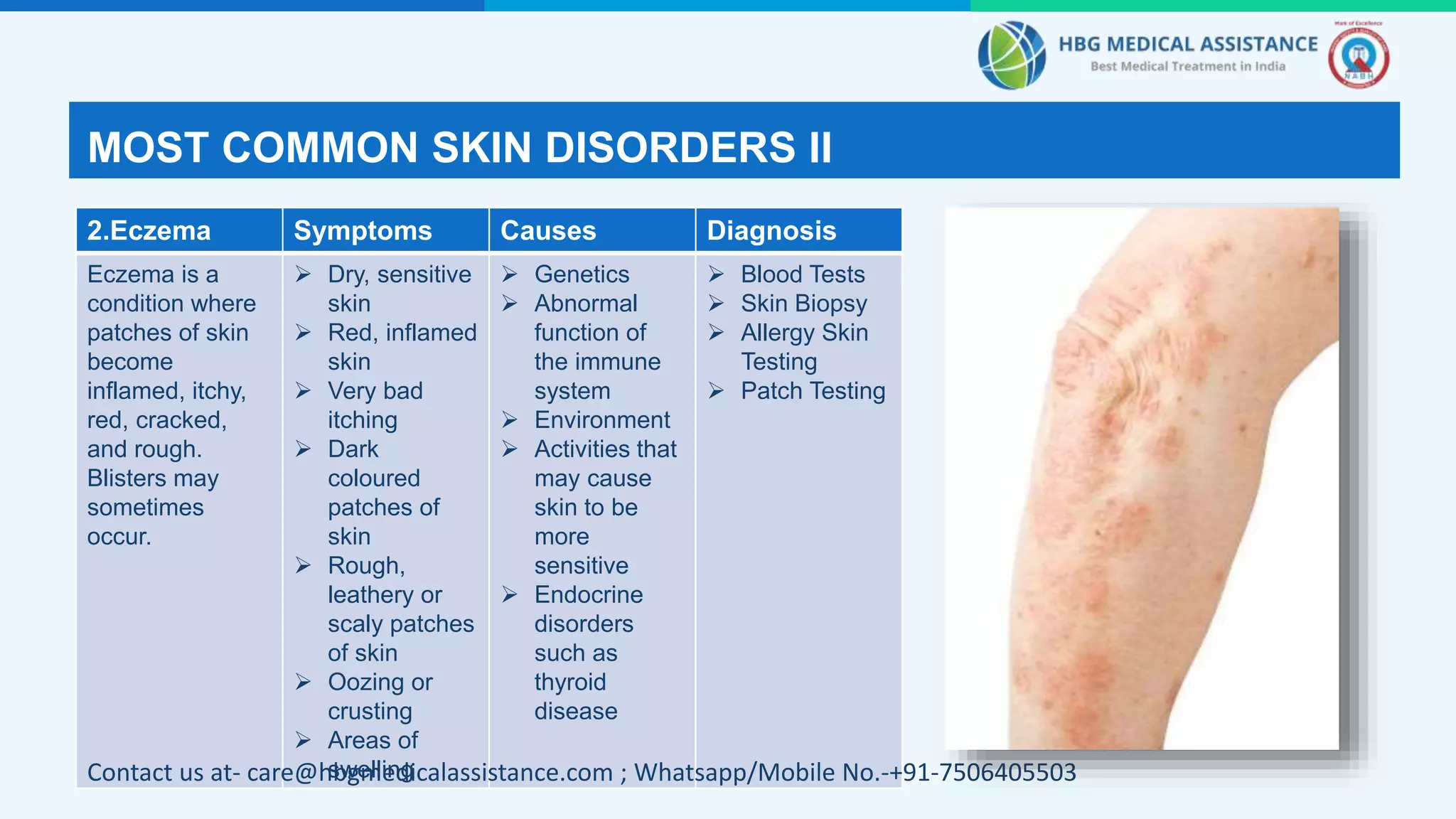 Ayurvedic Treatment of Skin Disorders in India | PPSX