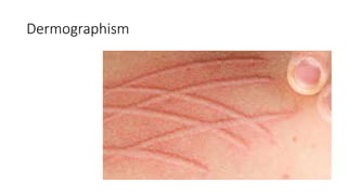 Skin Disorder Pictures | PPT | Free Download