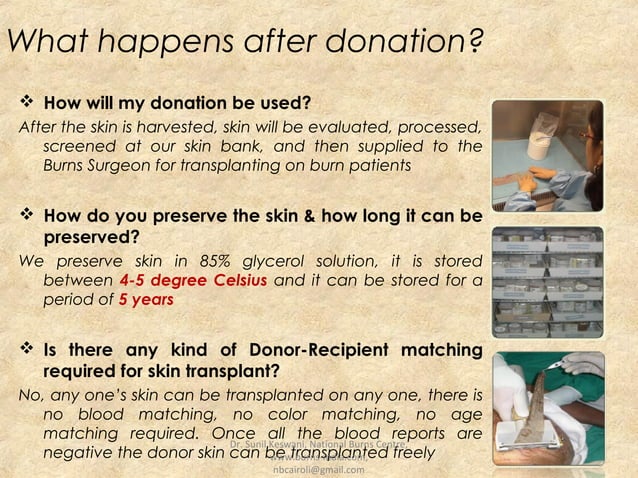 Skin donation awareness presentation new by Dr. Sunil Keswani, National ...
