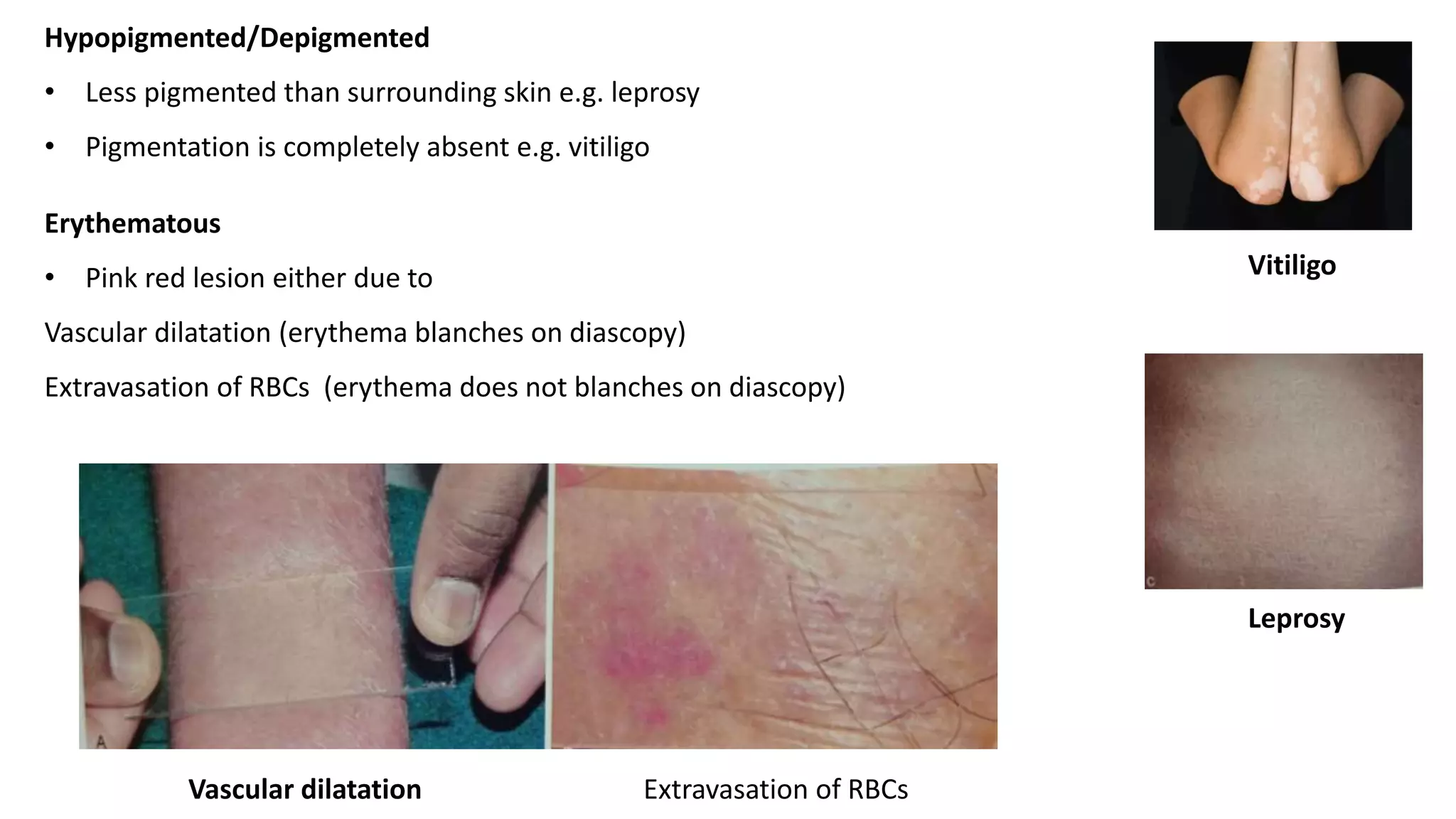Skin examination | PPTX