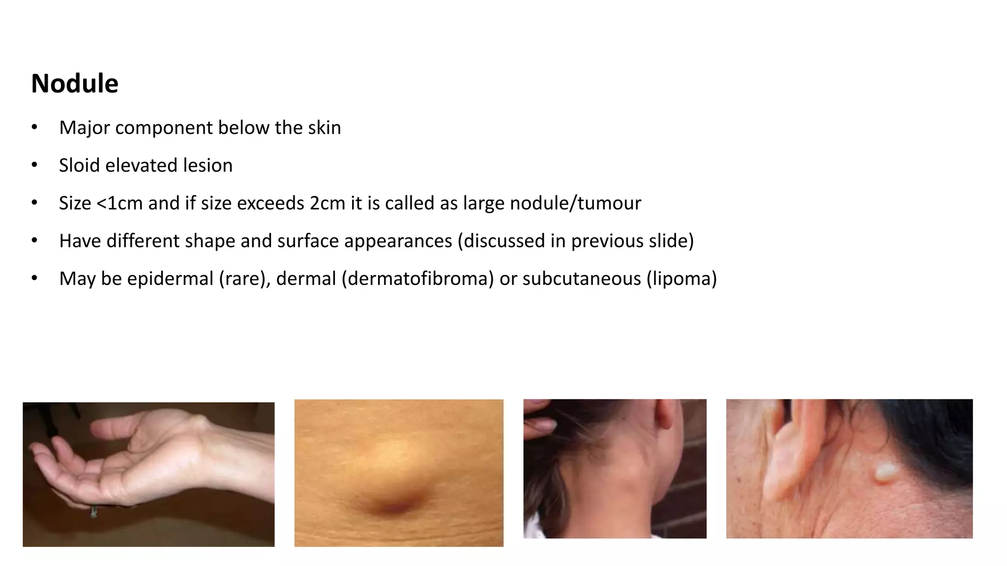 Skin examination | PPTX