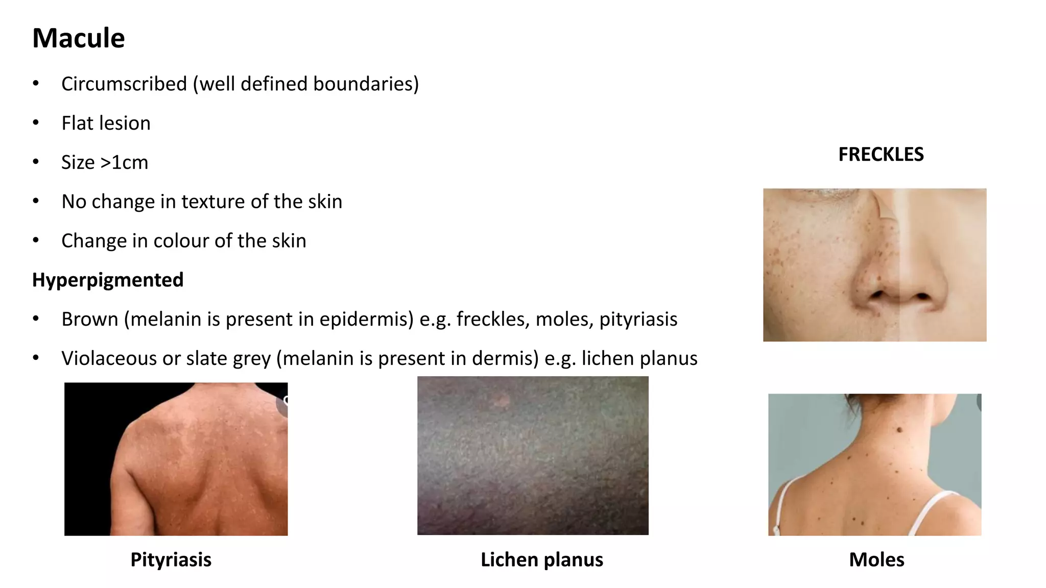 Skin examination | PPTX