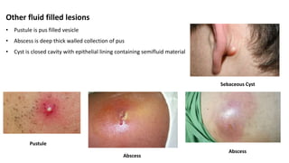 Skin examination | PPTX