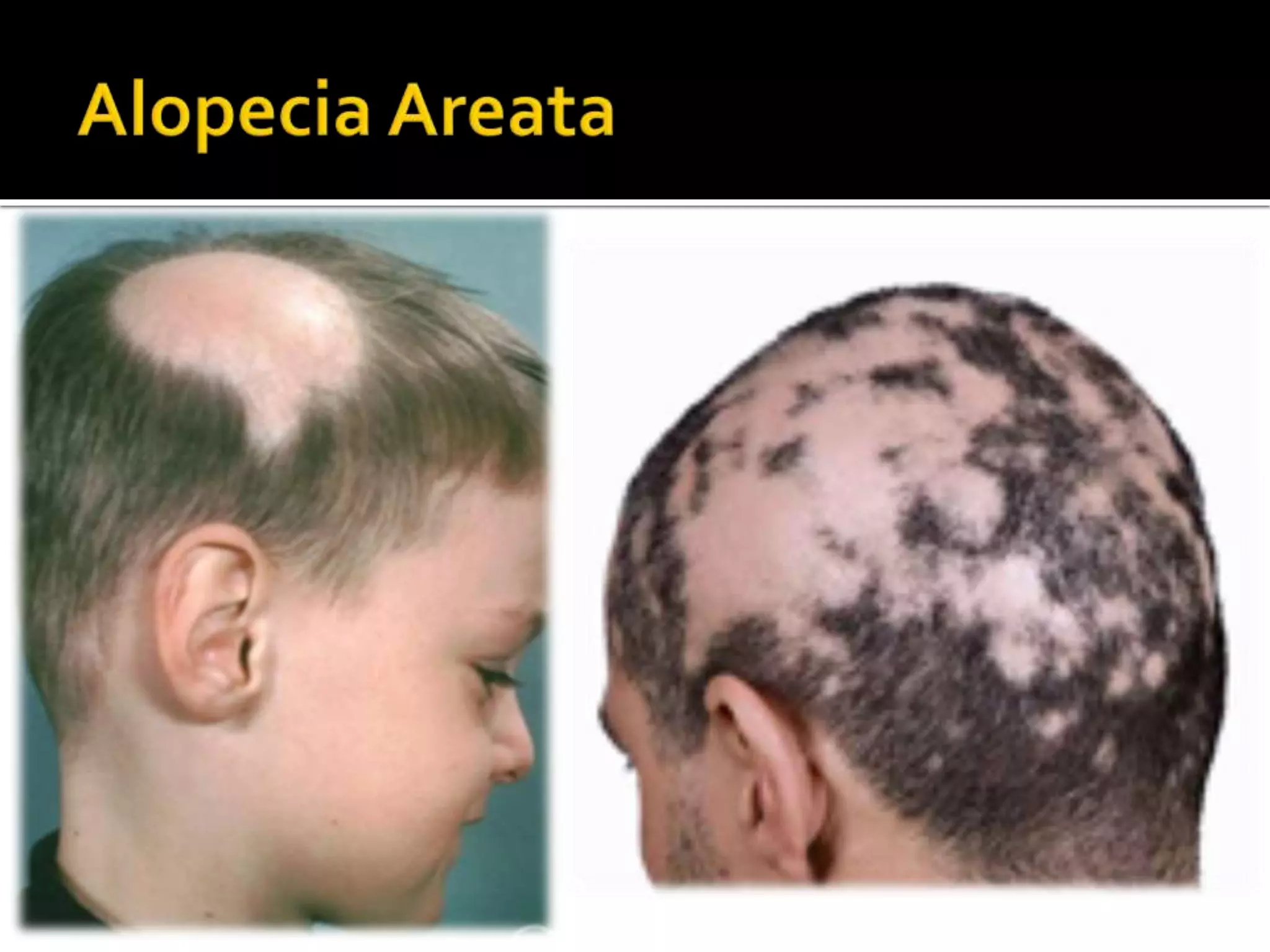 General anatomy of SKIN &FASCIA.pptx