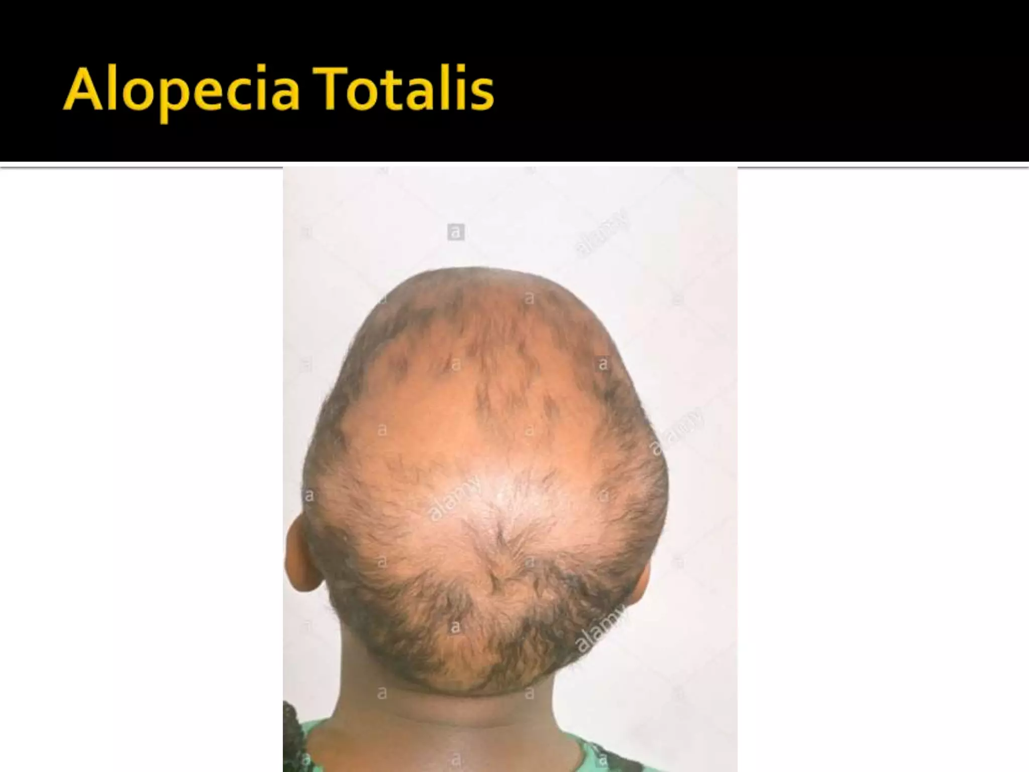 General anatomy of SKIN &FASCIA.pptx