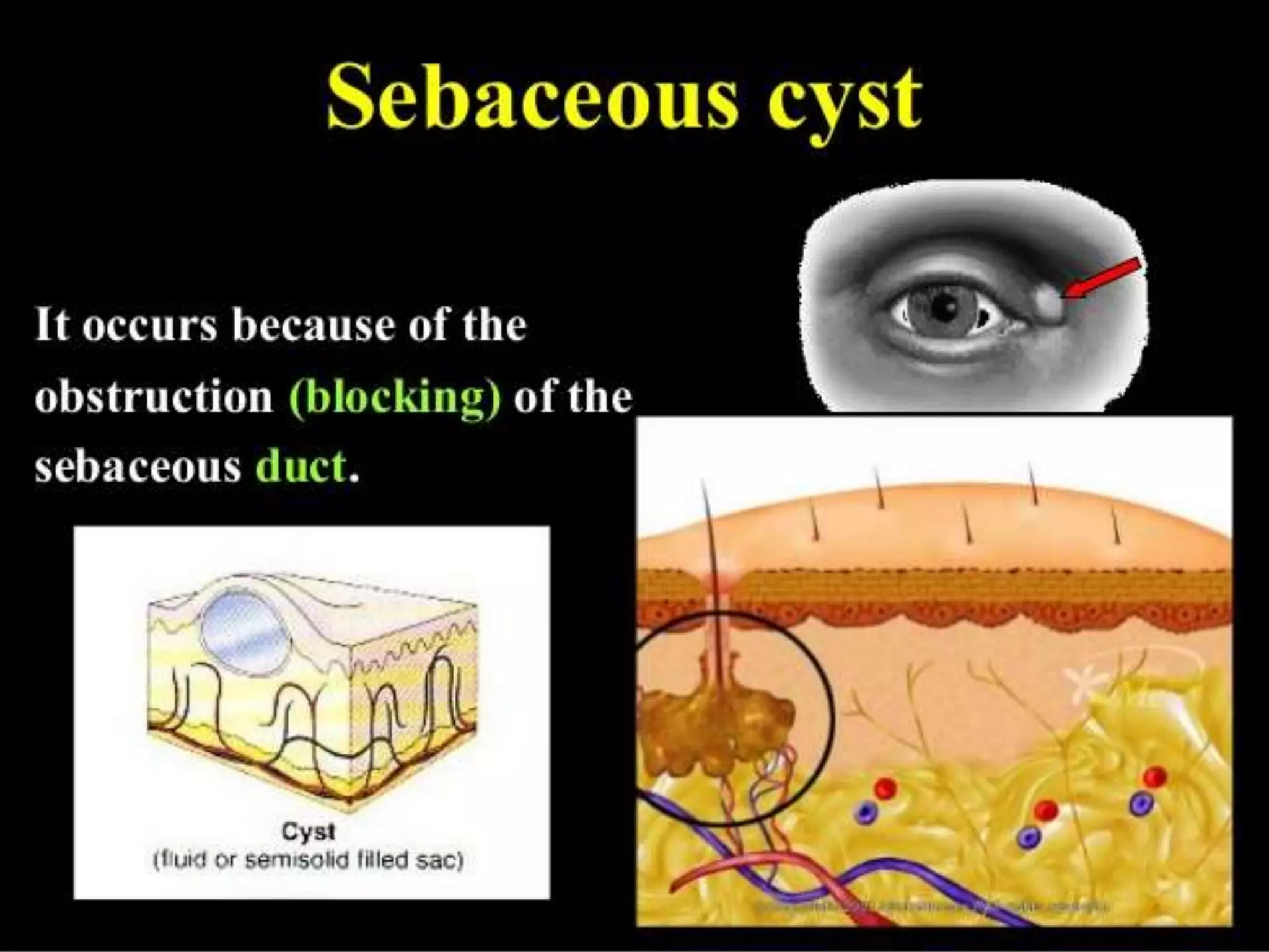 General anatomy of SKIN &FASCIA.pptx