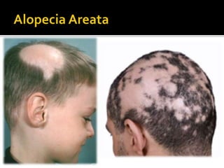 General anatomy of SKIN &FASCIA.pptx