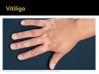 General anatomy of SKIN &FASCIA.pptx