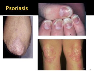 General anatomy of SKIN &FASCIA.pptx