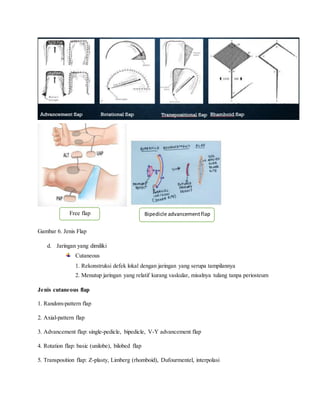 Skin graft and Flap | DOCX