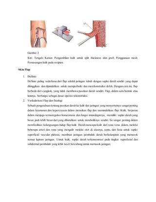 Skin graft and Flap | DOCX