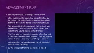 Skin flaps | PPTX