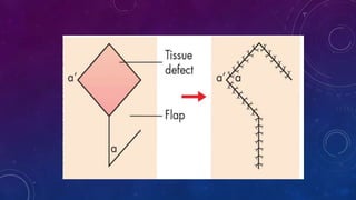 Skin flaps | PPTX