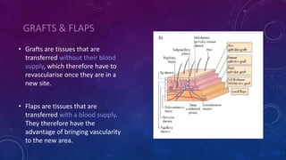 Skin flaps | PPTX