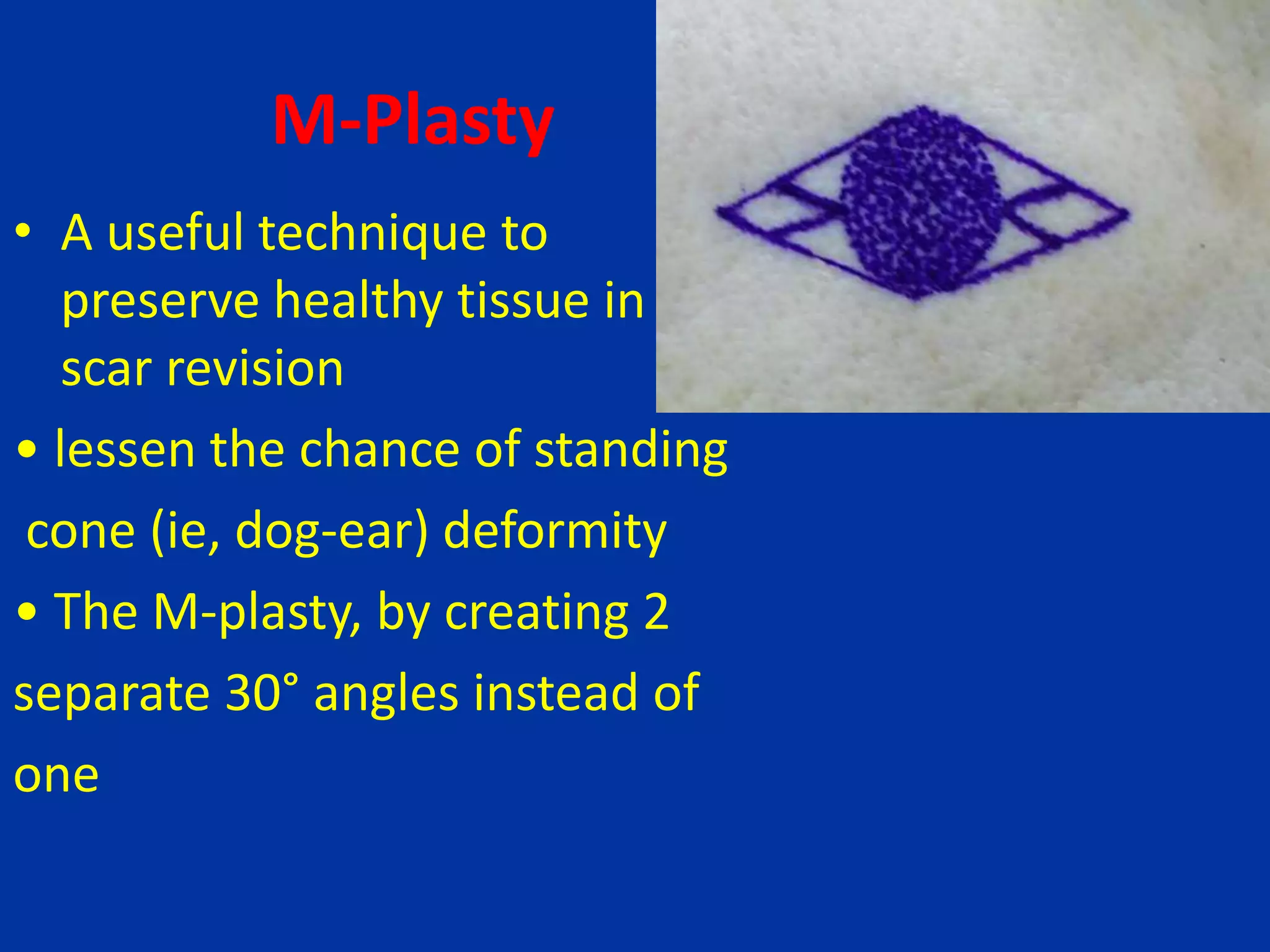 Skin flaps | PPTX