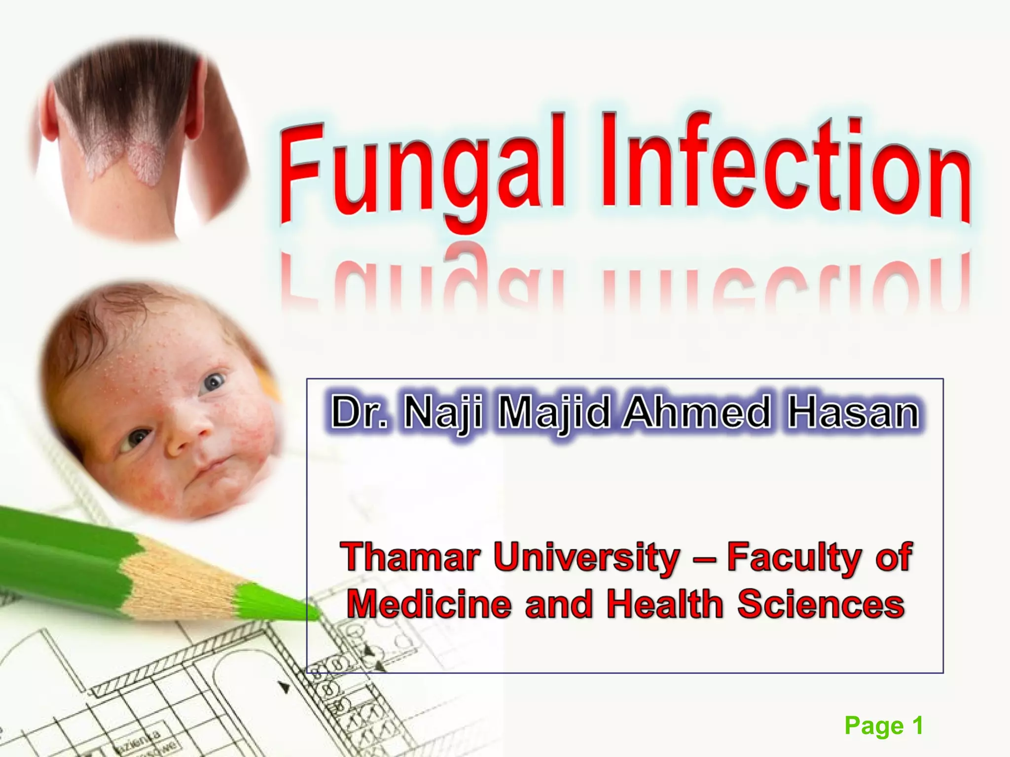 Skin fungal infection | PPT