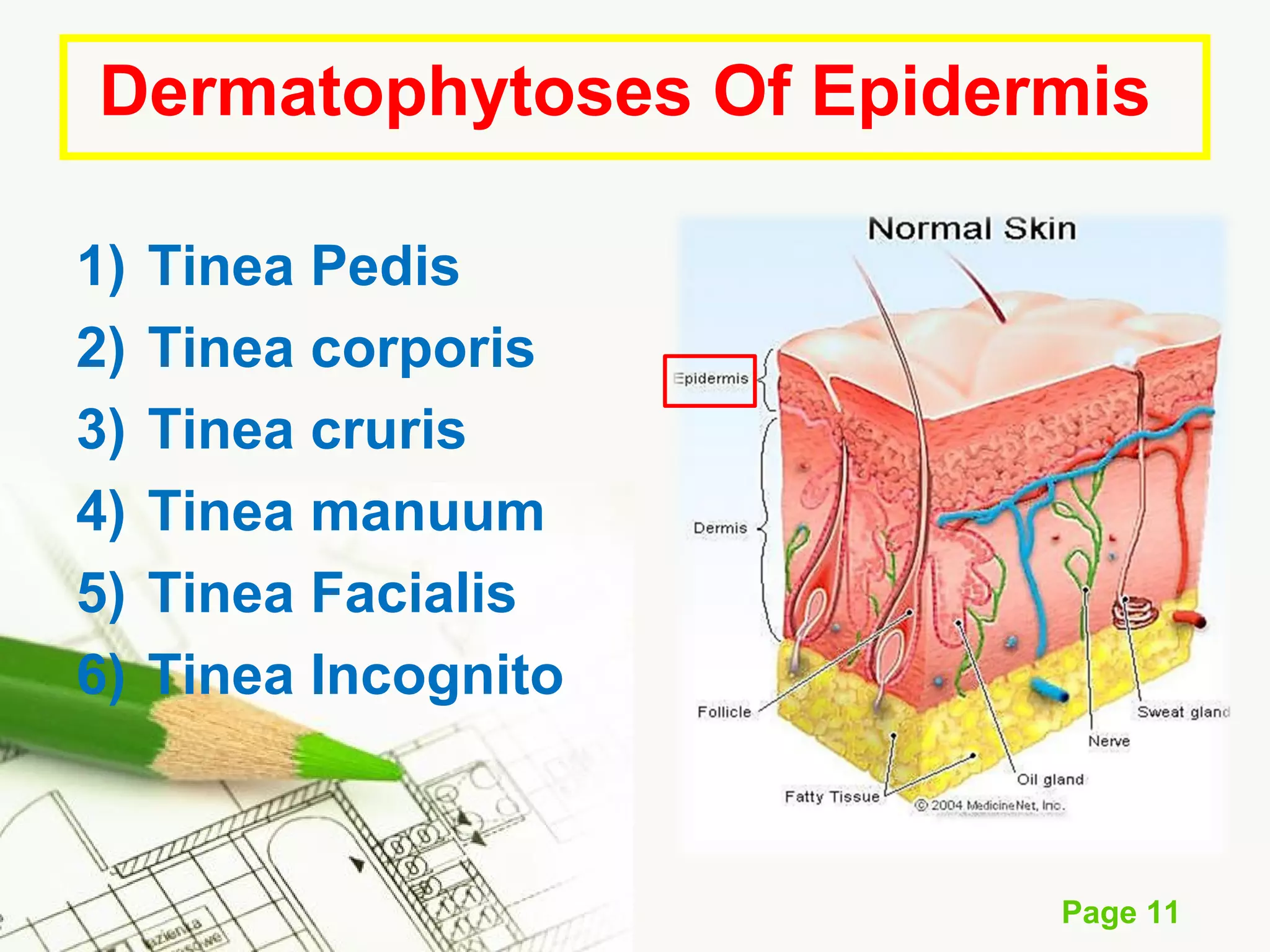 Skin fungal infection | PPT