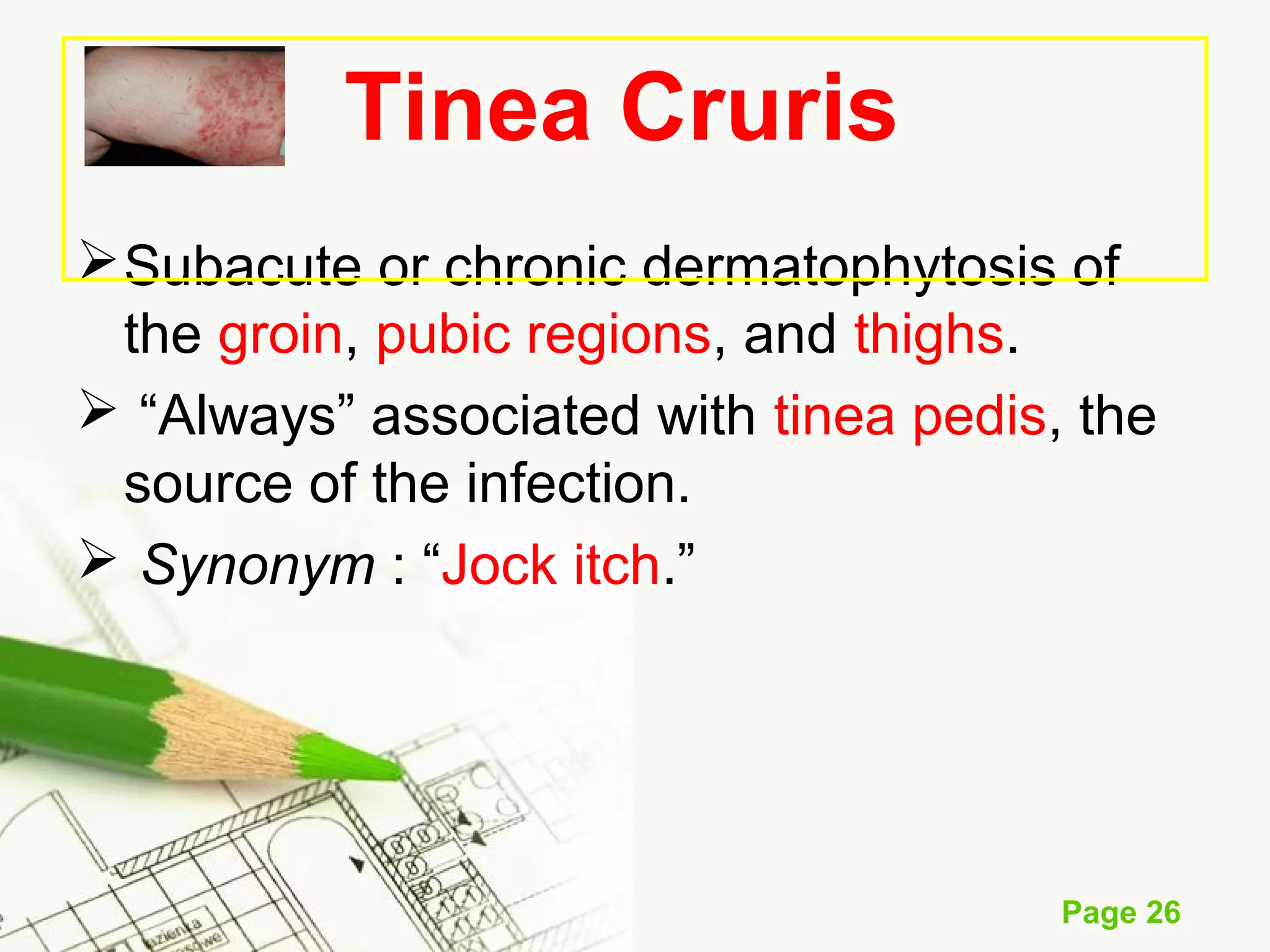 Skin fungal infection | PPT