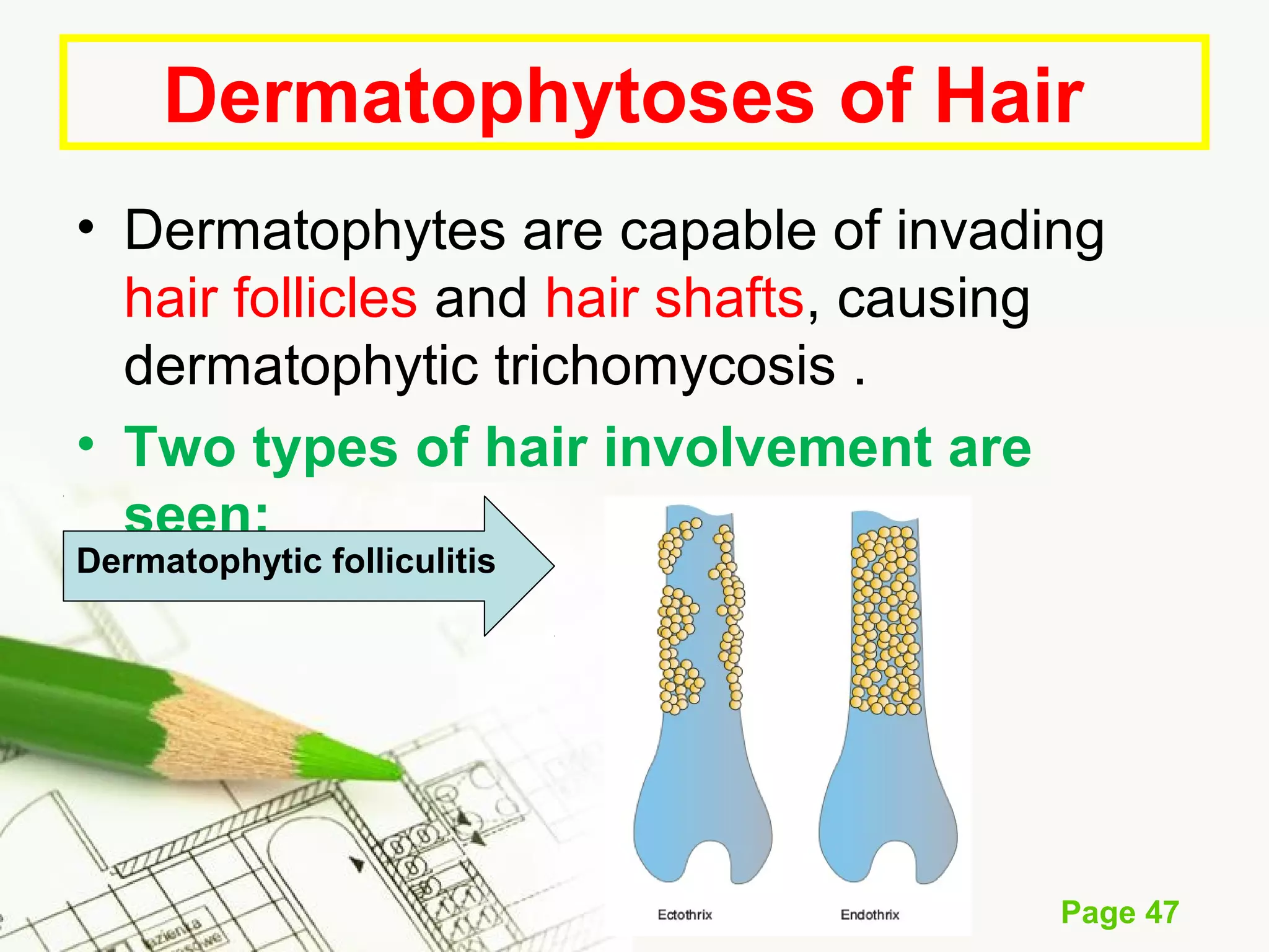Skin fungal infection | PPT