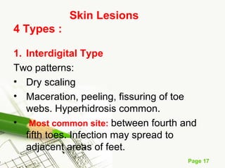 Skin fungal infection | PPT