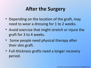 SKIN GRAFT | PPT