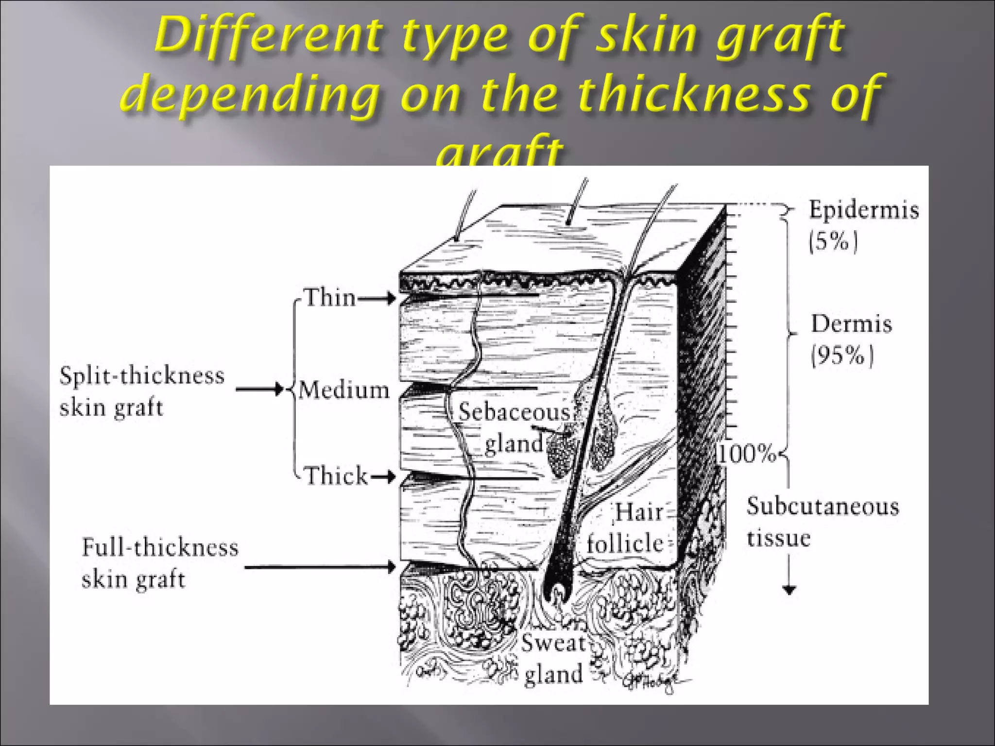 Skin graft , split skin grafting, STG , SSG , split thickness graft ...