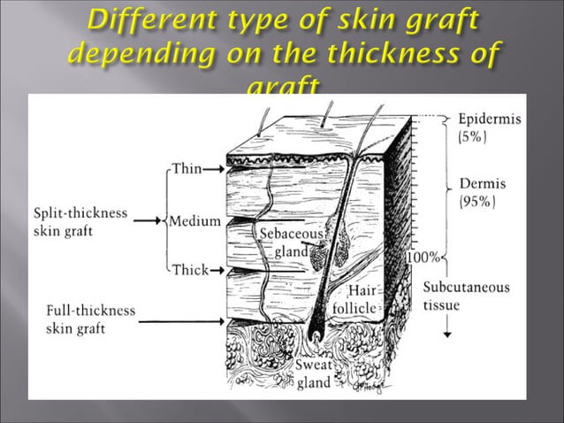 Skin graft , split skin grafting, STG , SSG , split thickness graft ...