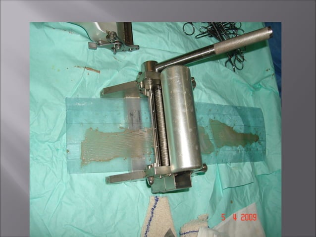 Skin graft , split skin grafting, STG , SSG , split thickness graft ...