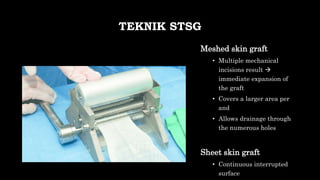 Skin graft and Flap surgery | PPTX