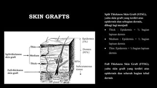 Skin graft and Flap surgery | PPTX