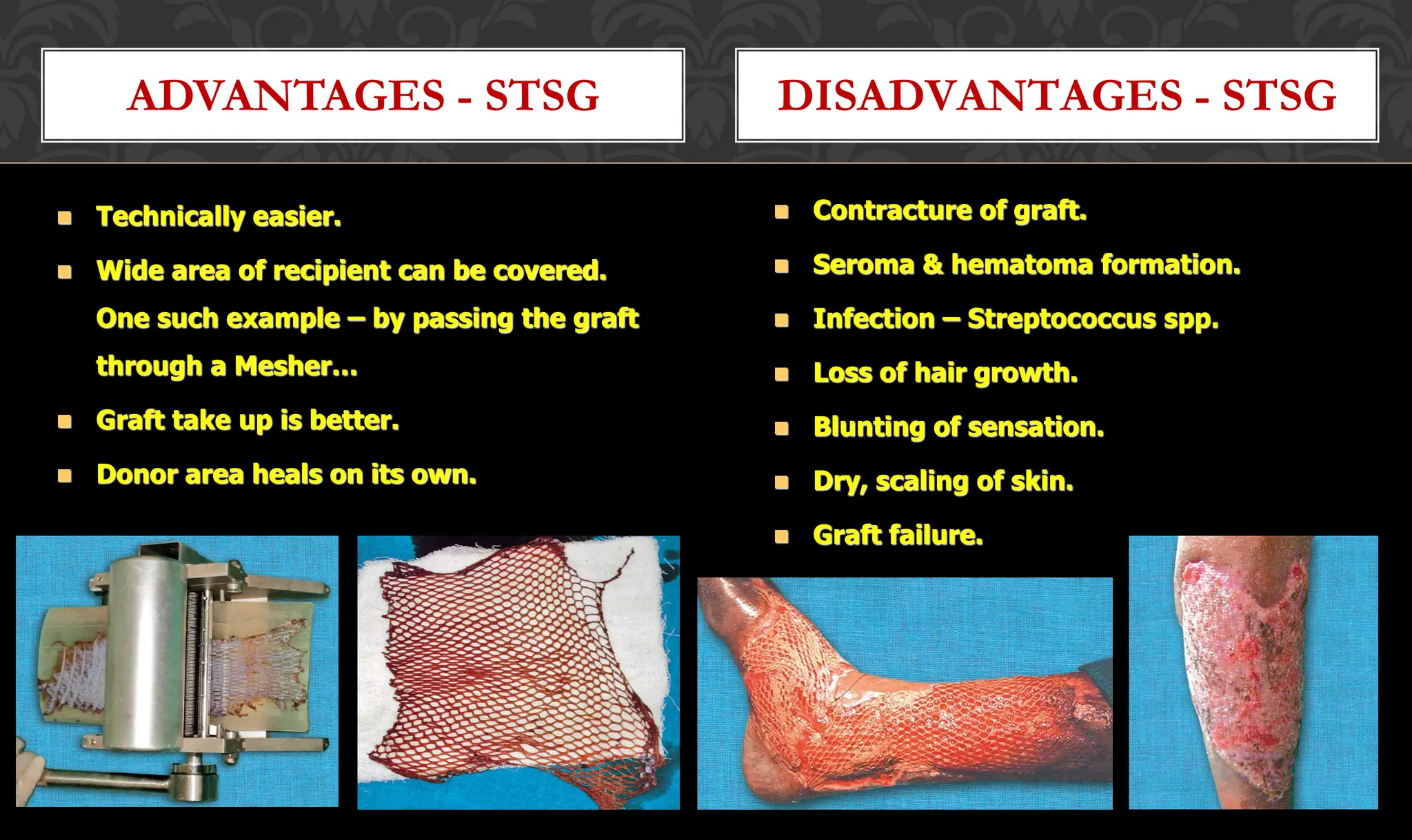 Skin Graft & Flap - Types, Technique, Advantages & Disadvantages | PDF