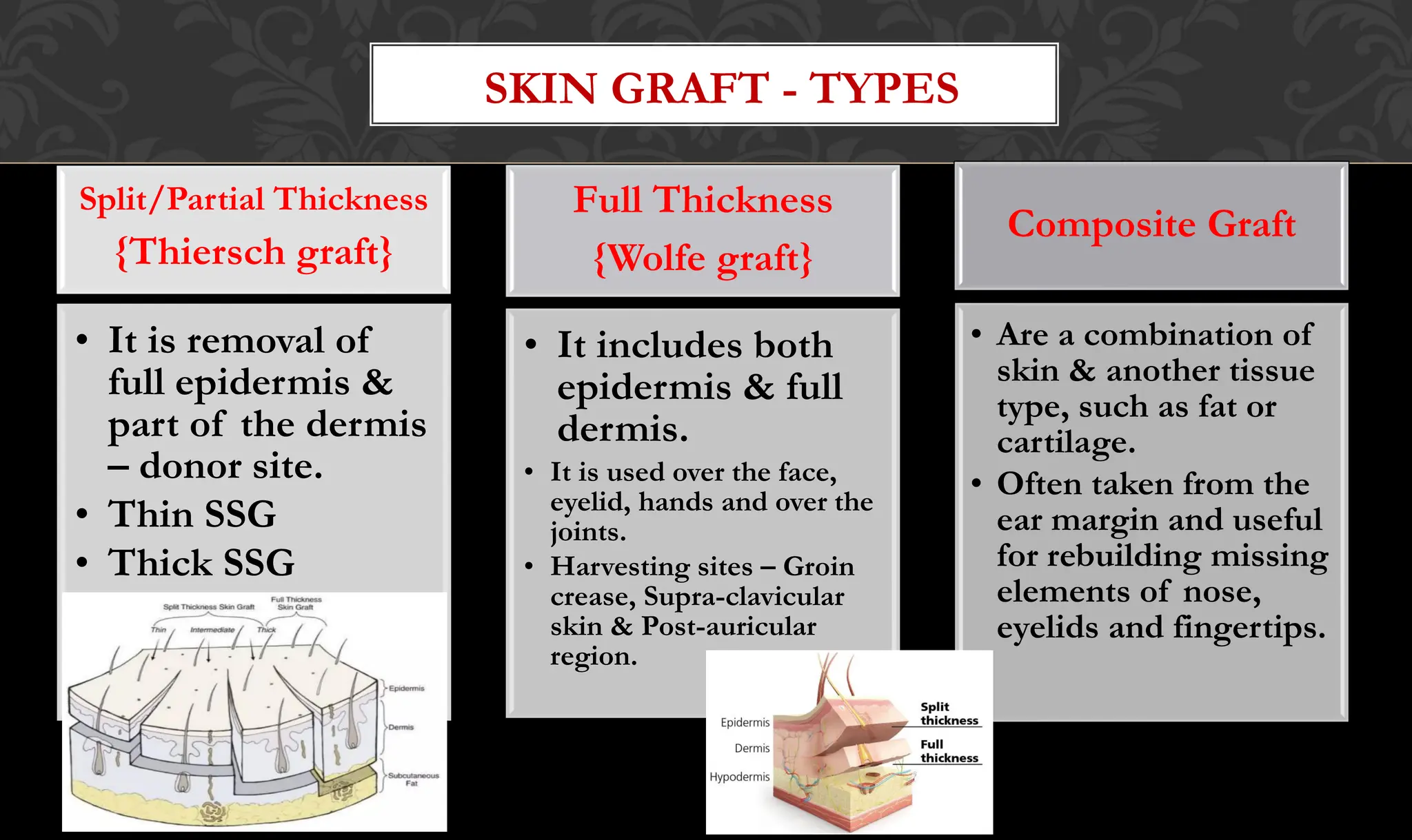 Skin Graft & Flap - Types, Technique, Advantages & Disadvantages | PDF