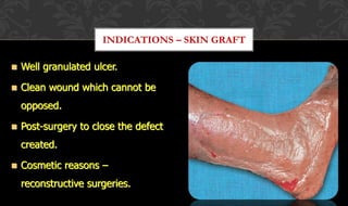Skin Graft & Flap - Types, Technique, Advantages & Disadvantages | PDF