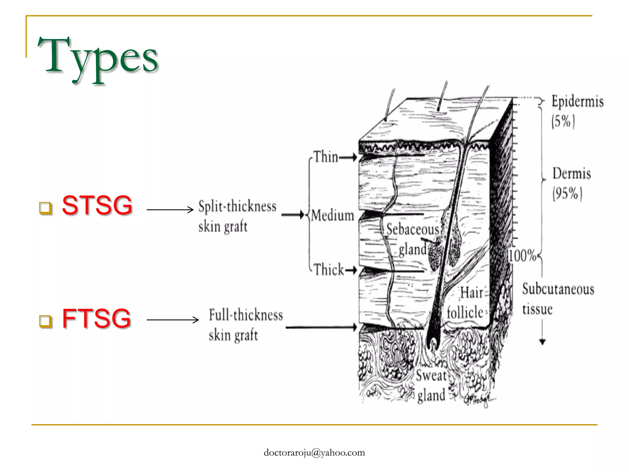 Skin grafting | PPTX