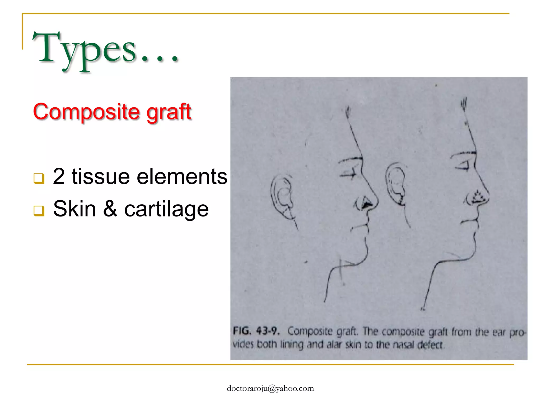 Skin grafting | PPTX
