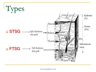 Skin grafting | PPTX