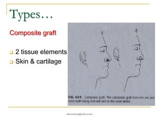 Skin grafting | PPTX