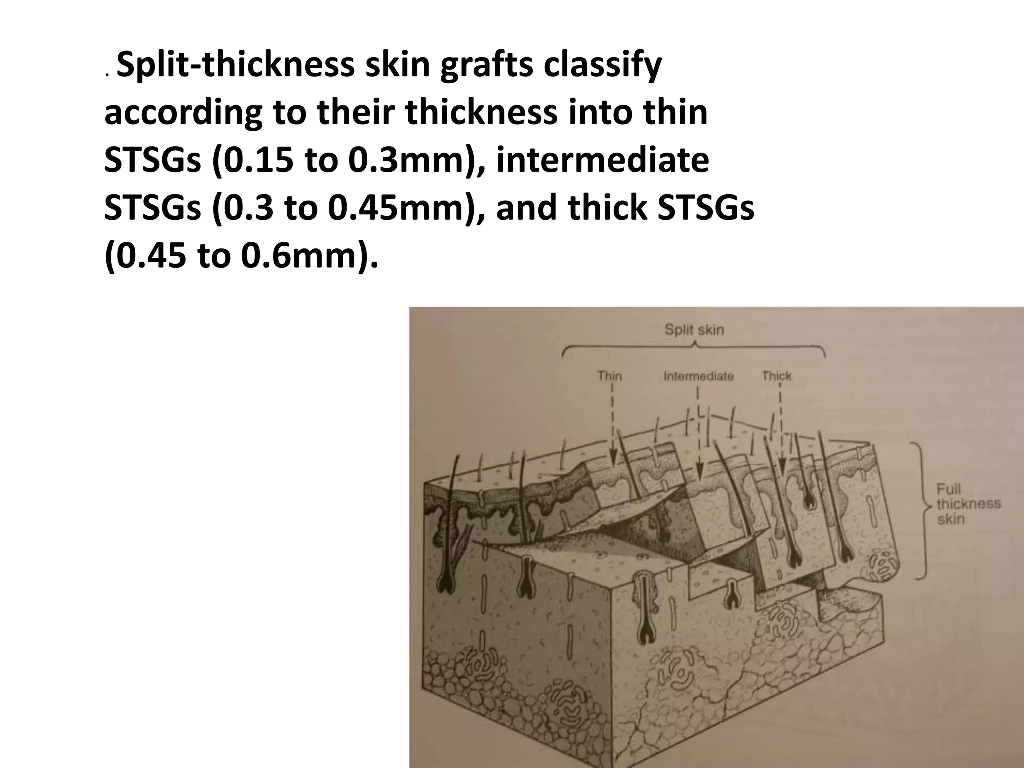 Skin grafting | PPTX