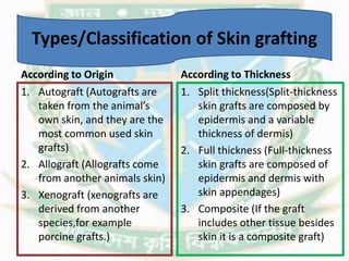 Skin Grafting.pptx
