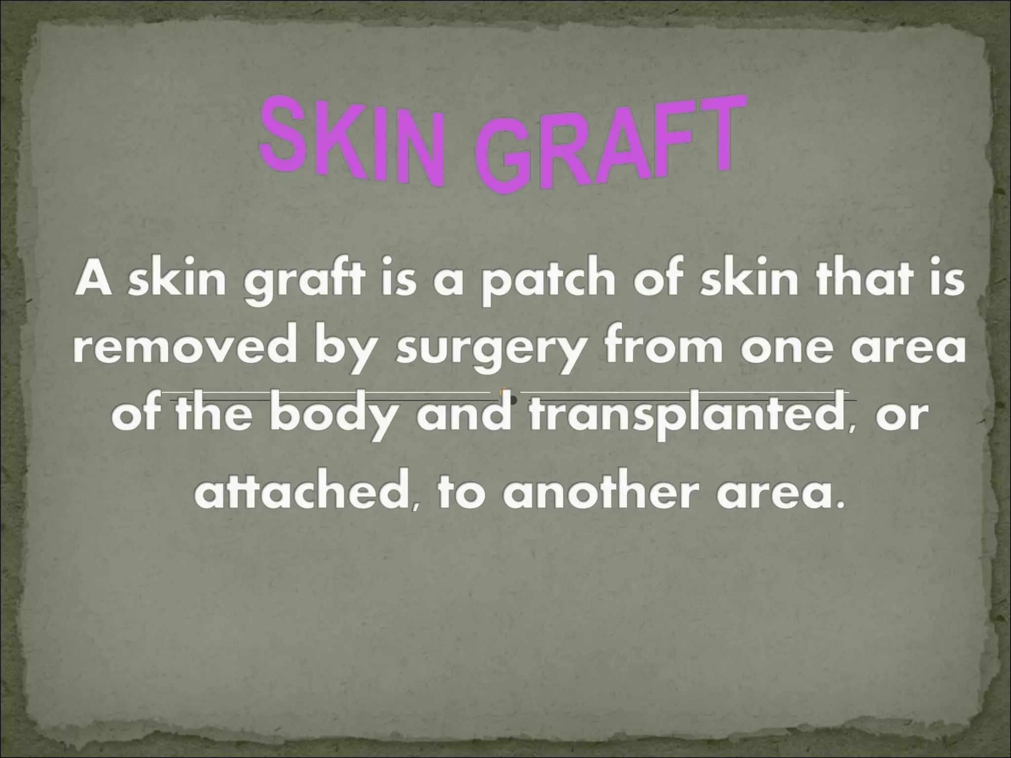 Skin Graft | PPT