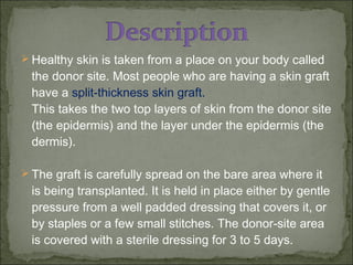 Skin Graft | PPT