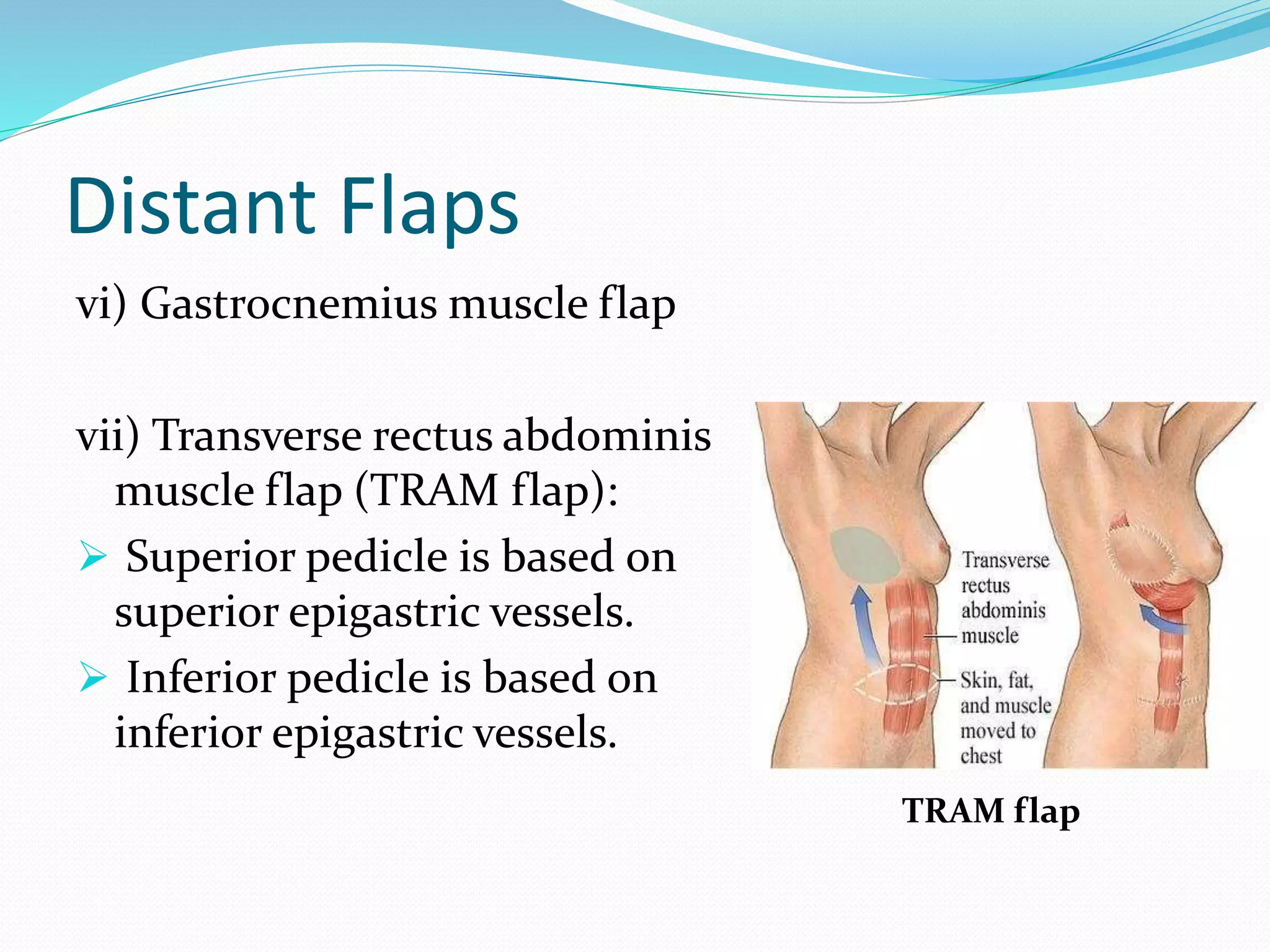 Skin grafts and skin flaps | PPTX