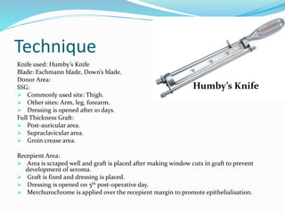 Skin grafts and skin flaps | PPTX