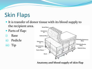 Skin grafts and skin flaps | PPTX
